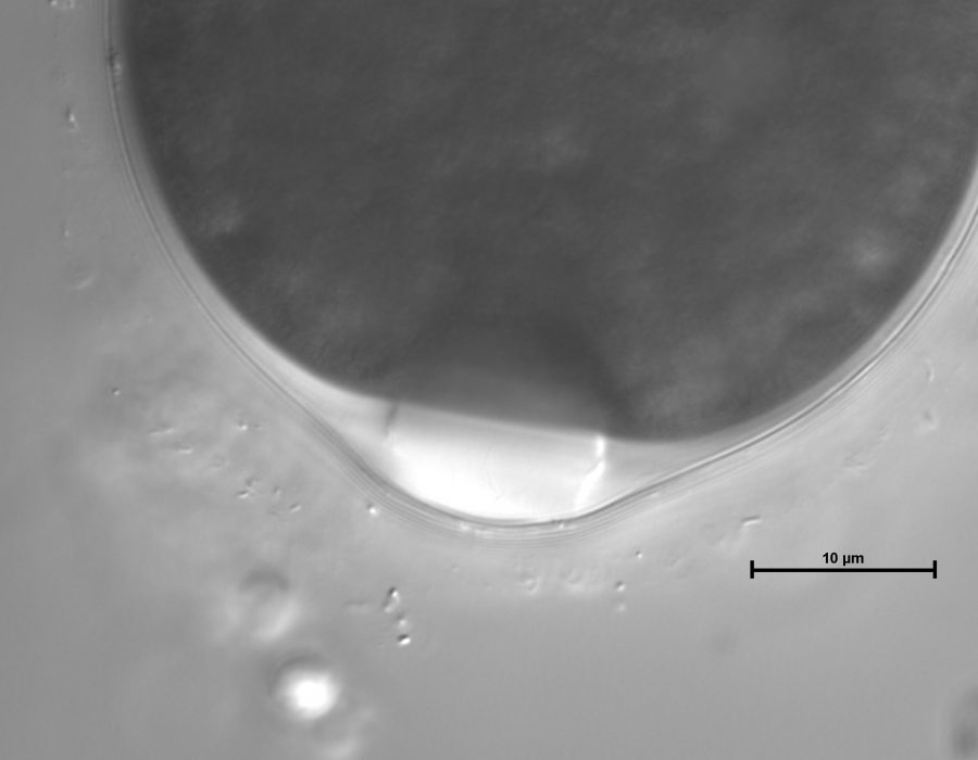 Pictures | The Microzooplankton Lab
